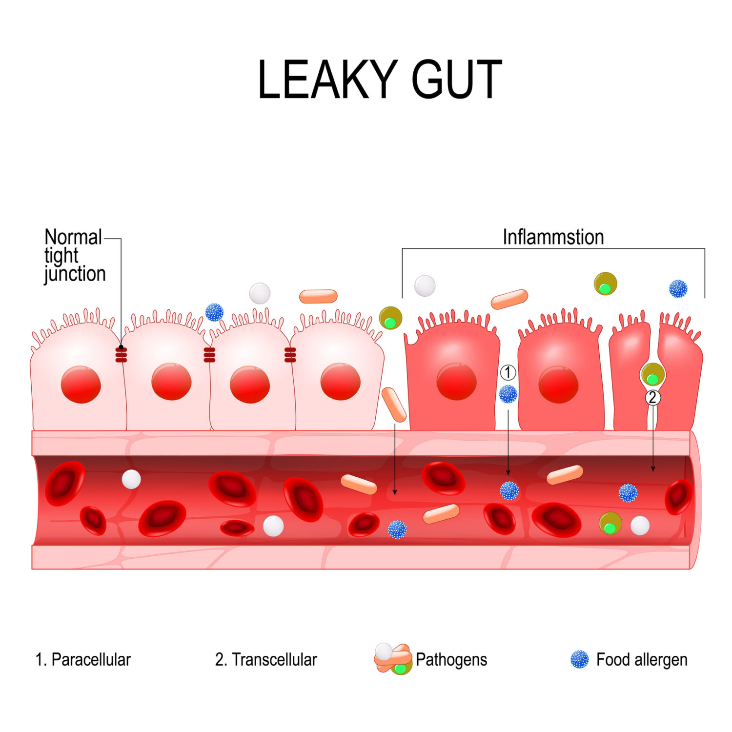 Butyrate Supplements: Butyric Acid & Optimal Gut